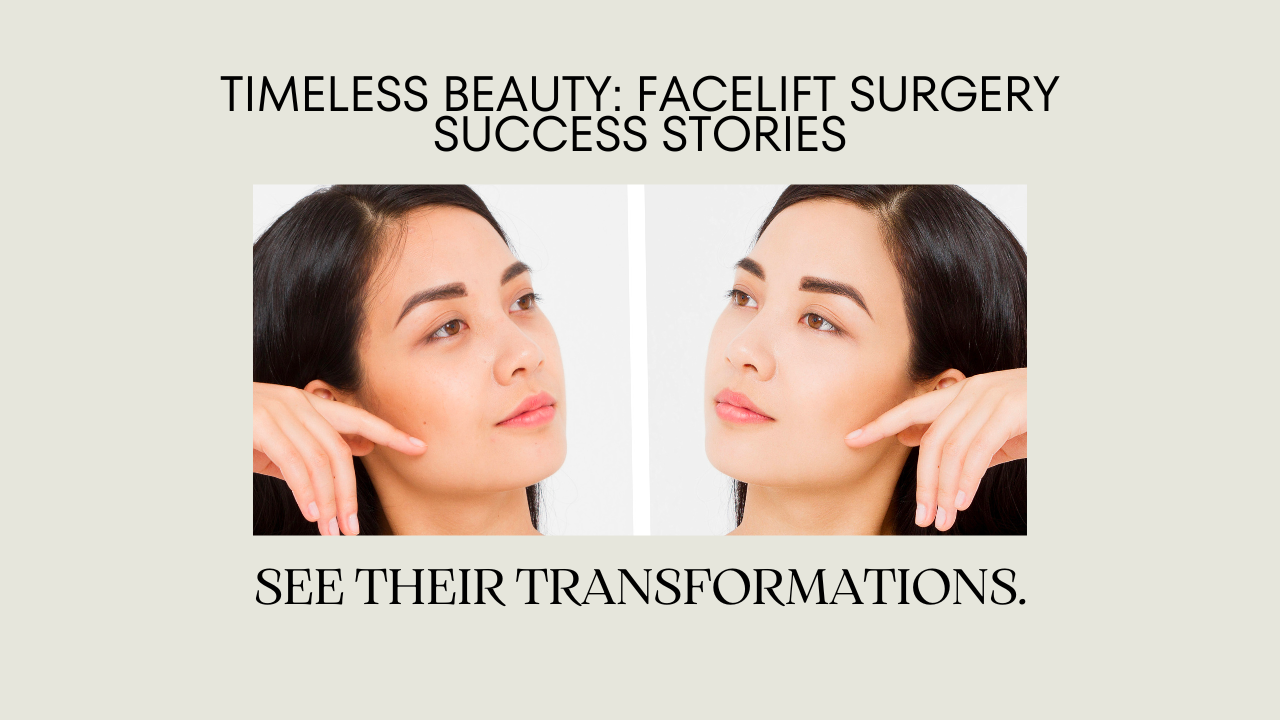 Facelift Surgery: Your Journey to Timeless Beauty Unveiled | by ...