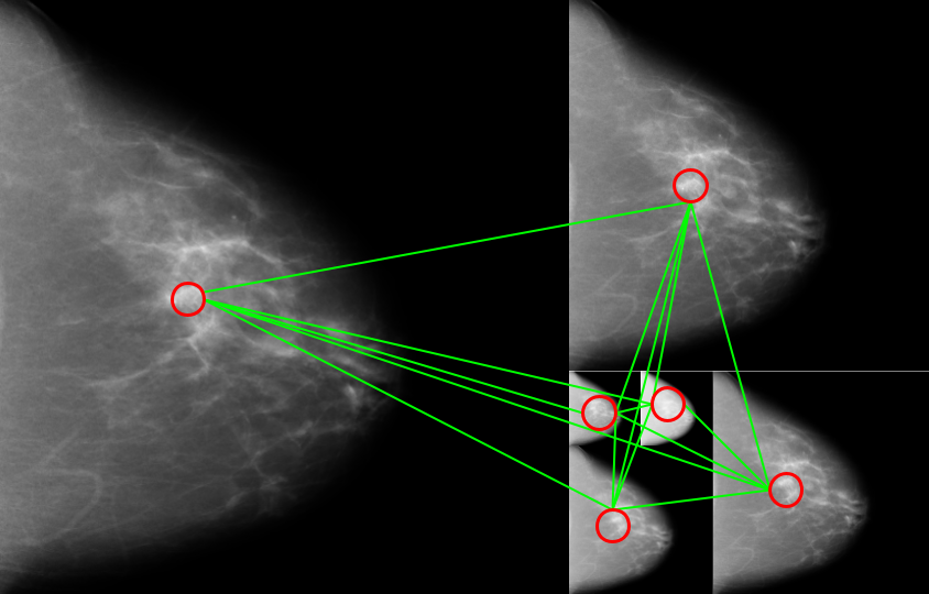 Final DXA-nation. AI can see the end! Deep learning… | by Lambert T Leong, PhD | Towards Data ...