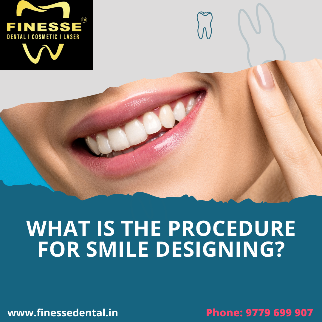 Maxillofacial Surgery: Procedure, Details and Complications | by ...