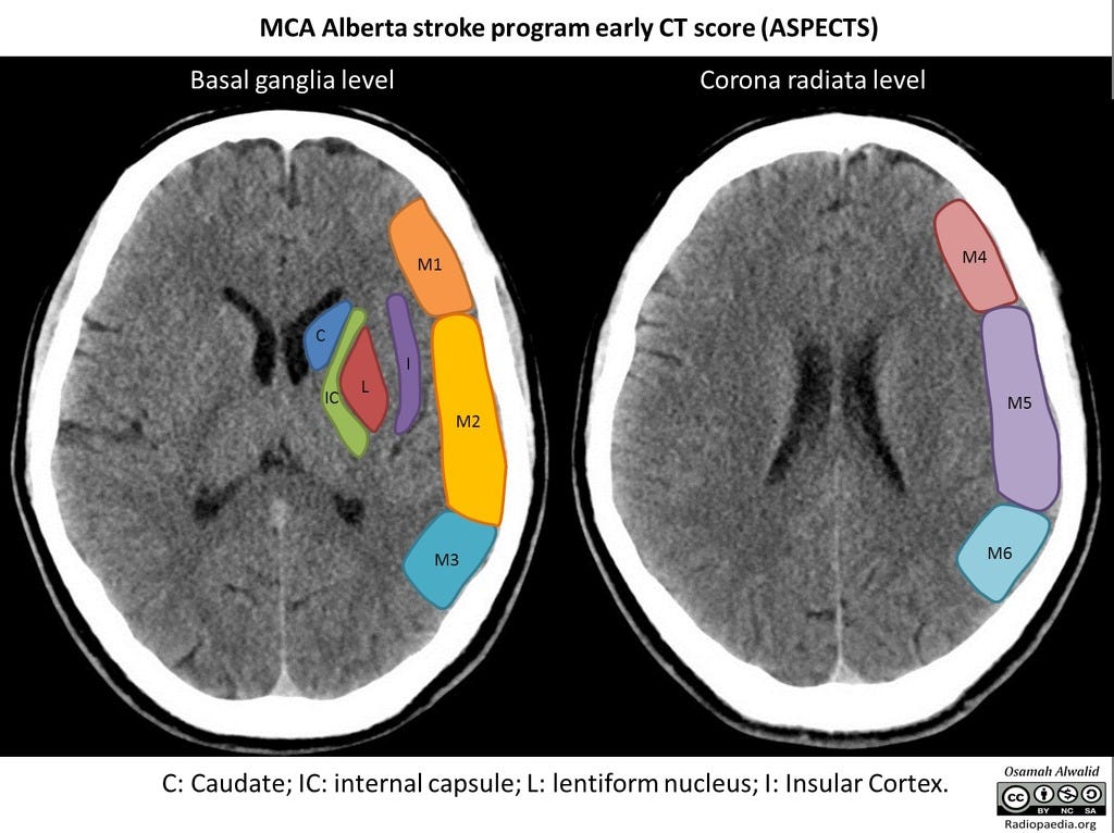 3D Vascular Segmentation Using Deep Learning | by CEREBRA | Medium