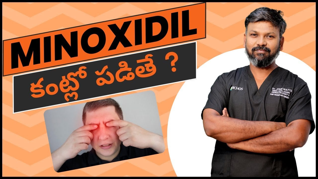 Does Typhoid hair loss occur in the third month of Typhoid or can it ...