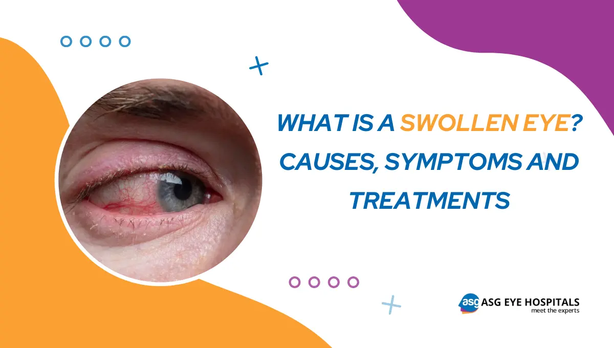 What are the Difference between Endophthalmitis and Panophthalmitis ...