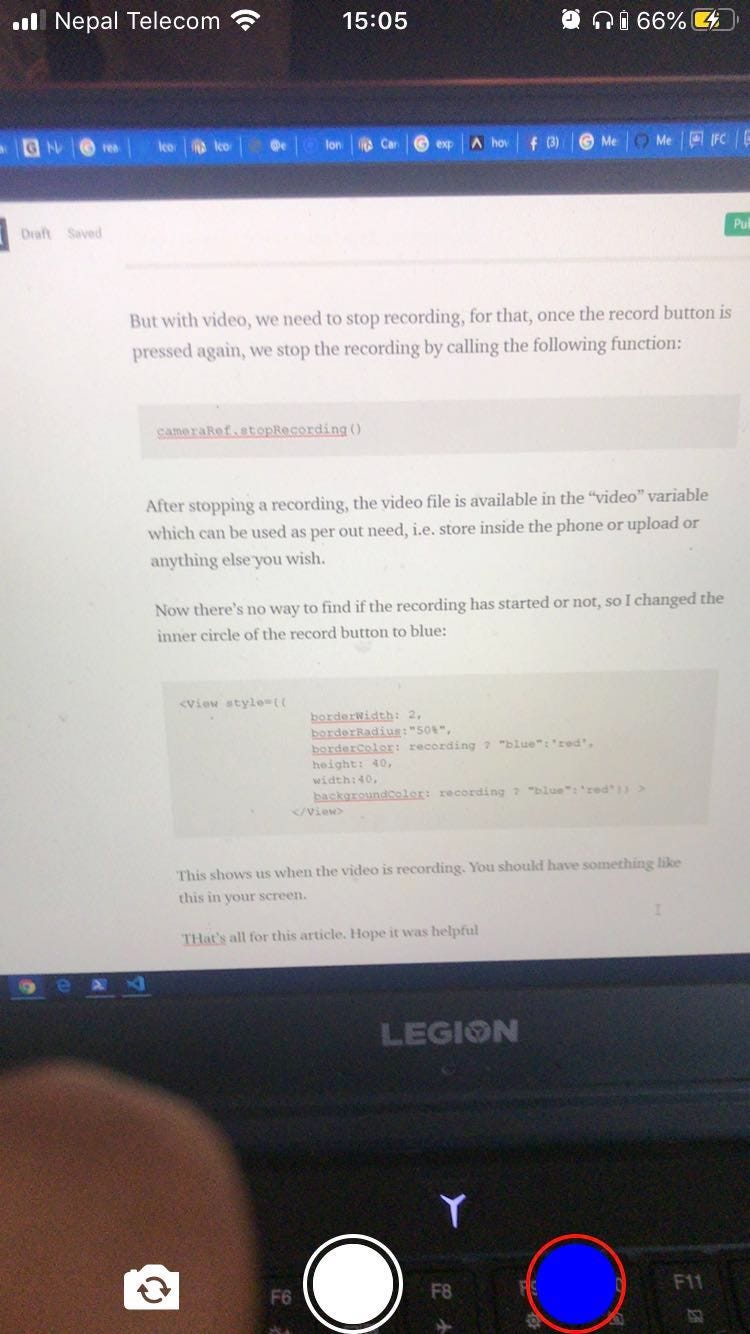 Create Selections and Annotations on High-Resolution Zoomable Images in ReactJS ( OpenSeadragon ...