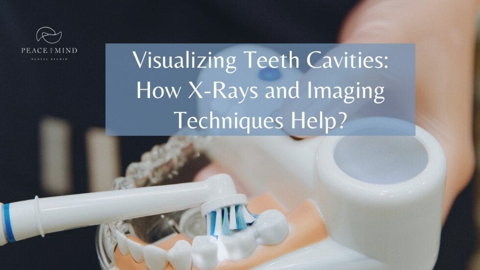 Smile Makeover: How Dental Bonding Can Transform Your Teeth? | by Peace ...