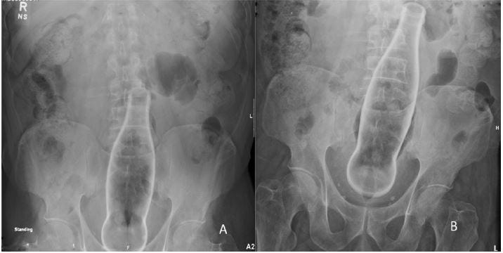 Why is My Belly Button Shaped Like This? | by Sam Westreich, PhD | Aha ...