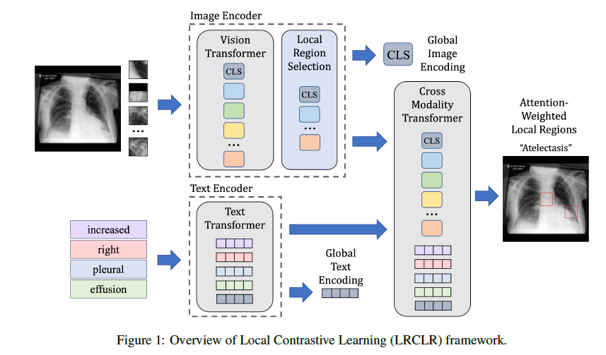 Papers Explained 13: Layout LM v3 | by Ritvik Rastogi | DAIR.AI | Medium