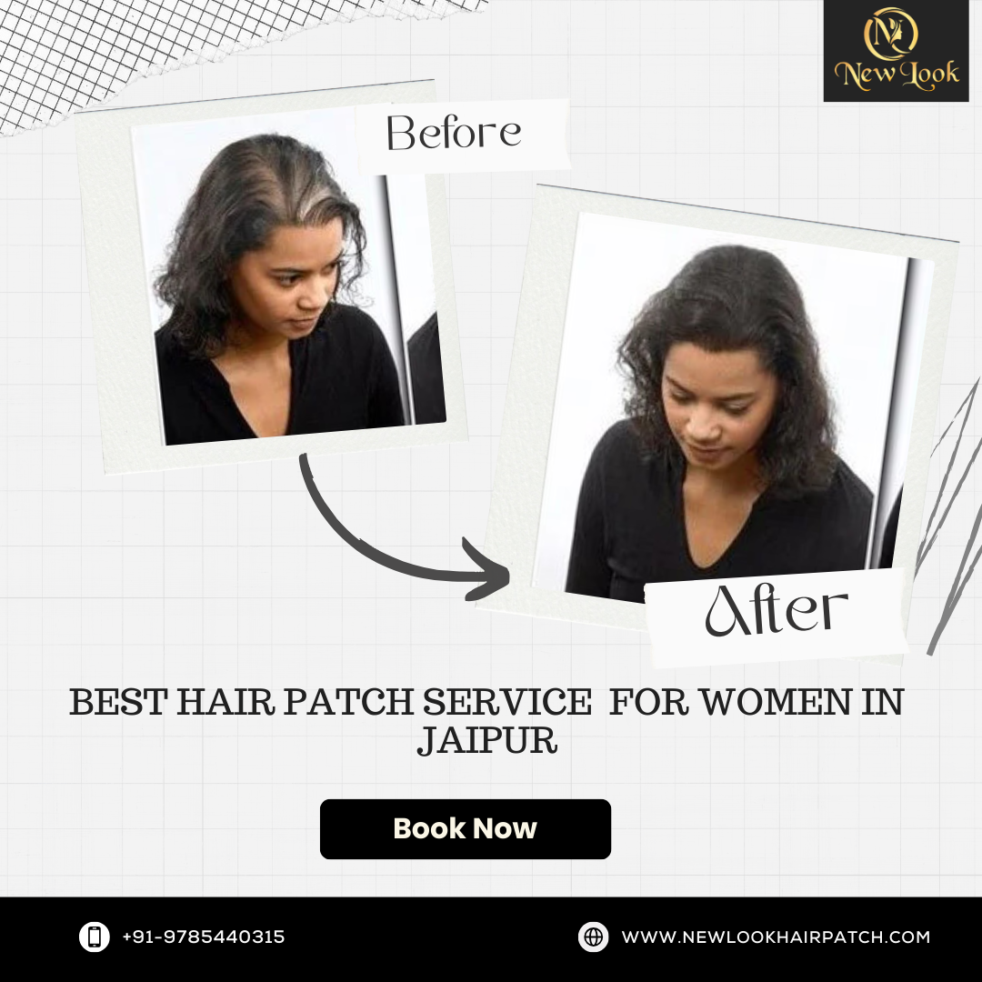 Hair Patch Services for Men in Jaipur: Get a Fuller Look Today | by ...