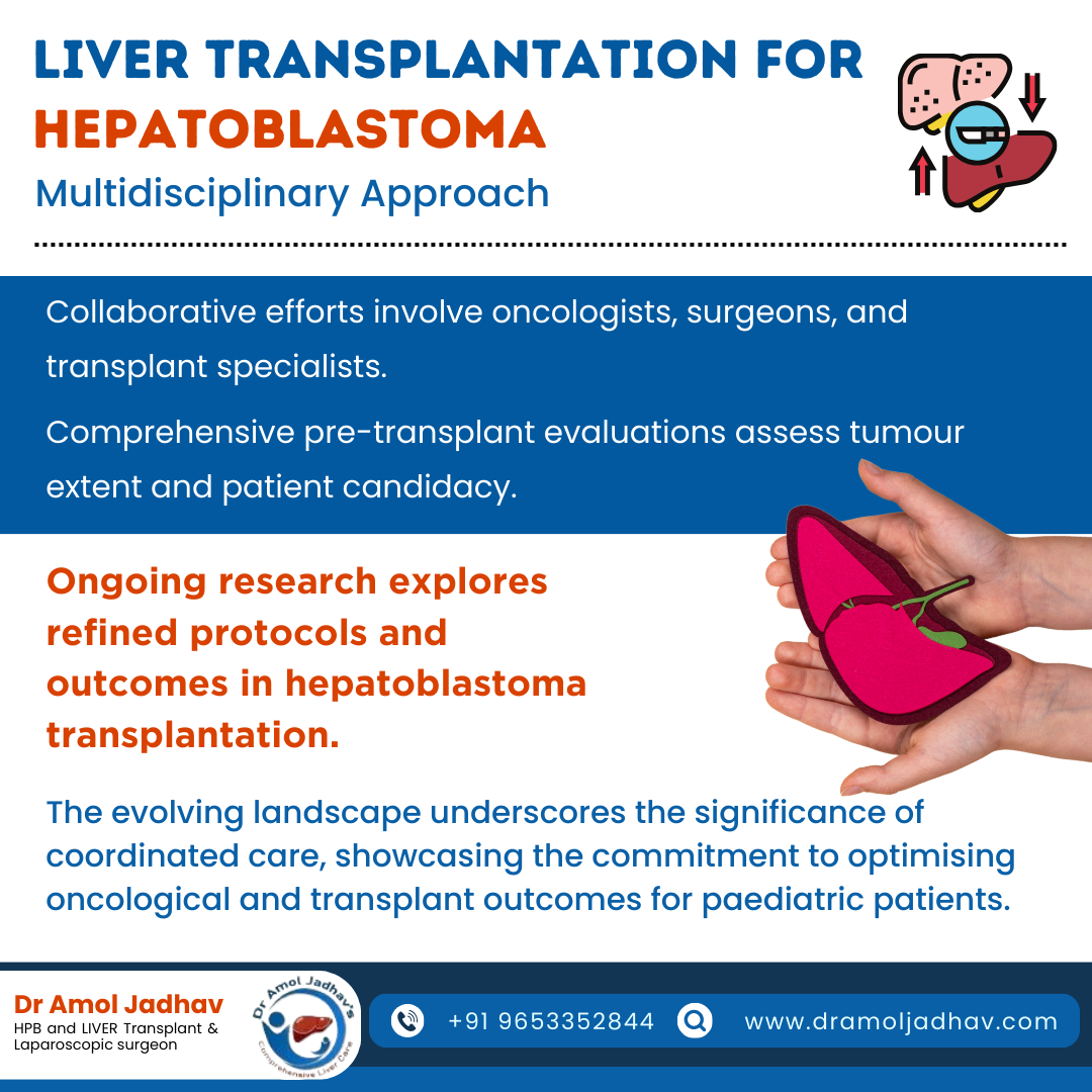 Laparoscopic Liver Surgery For Hepatic Cysts | Dr. Amol Jadhav | Best ...