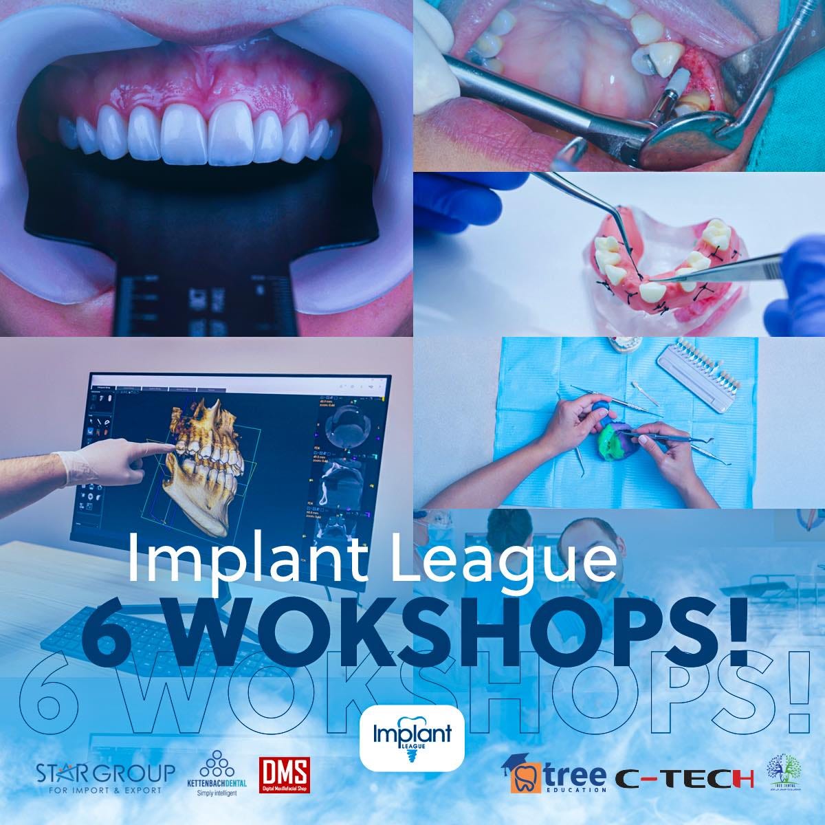 Mastering Dental Implantology: One-to-One Courses, Photography Basics ...