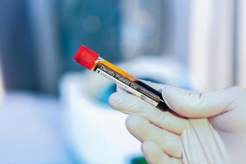 Enhancing PRP Therapy with Advanced Blood Component Separation Devices ...
