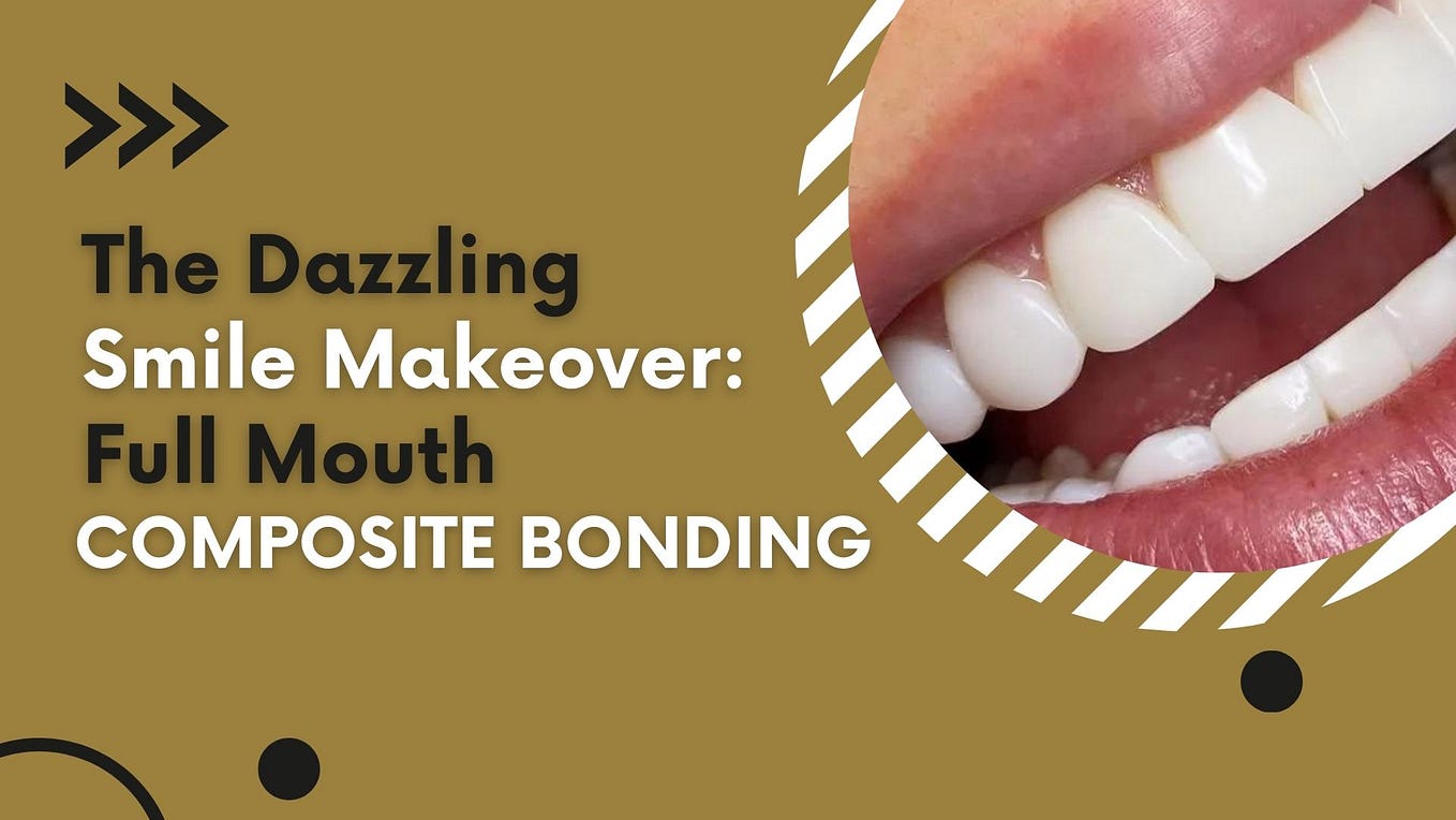 The Power of Composite Bonding for Beautiful Teeth - Thousand Smiles ...