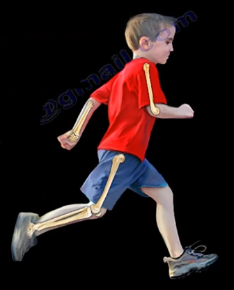 Fractures and Bone Remodeling in Children | by Nabil Ebraheim | Jun ...