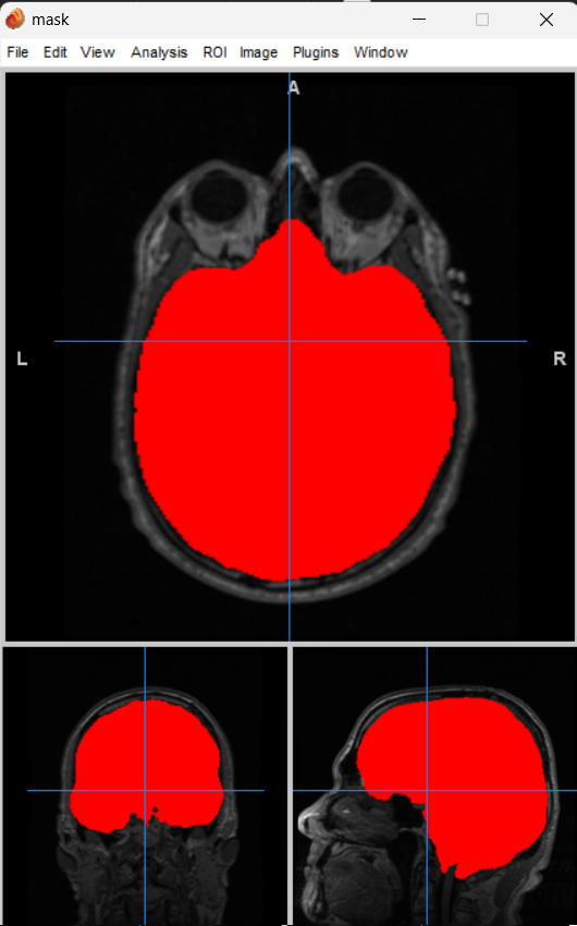Tutorial: Segmenting Your Brain in MRI — No Installation, Just Containers! | by Mithilesh | Medium
