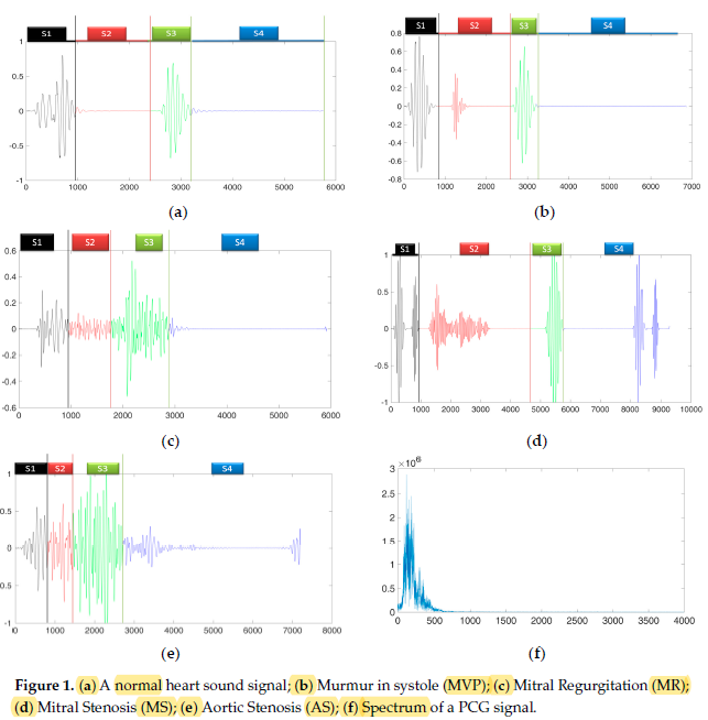 Brief Review — Classifier identification using deep learning and machine learning algorithms for ...