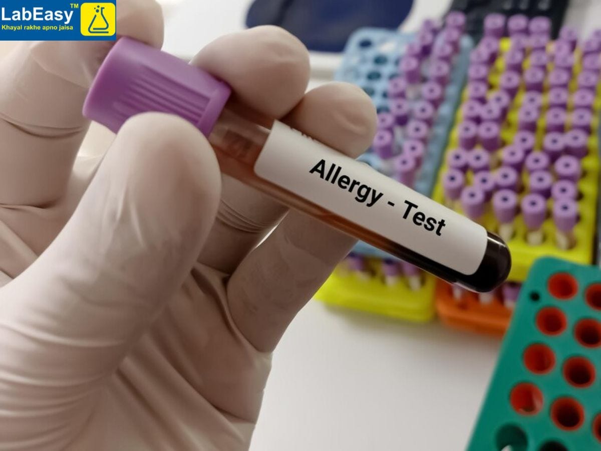 Allergy Test Center In Pune. Introduction: In the bustling city of ...