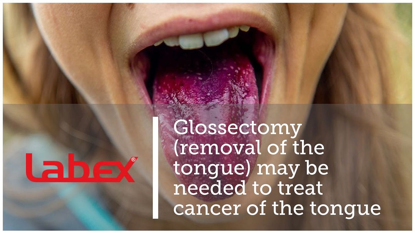 Maxillectomy surgery — everything you need to know | by Laryngectomy ...