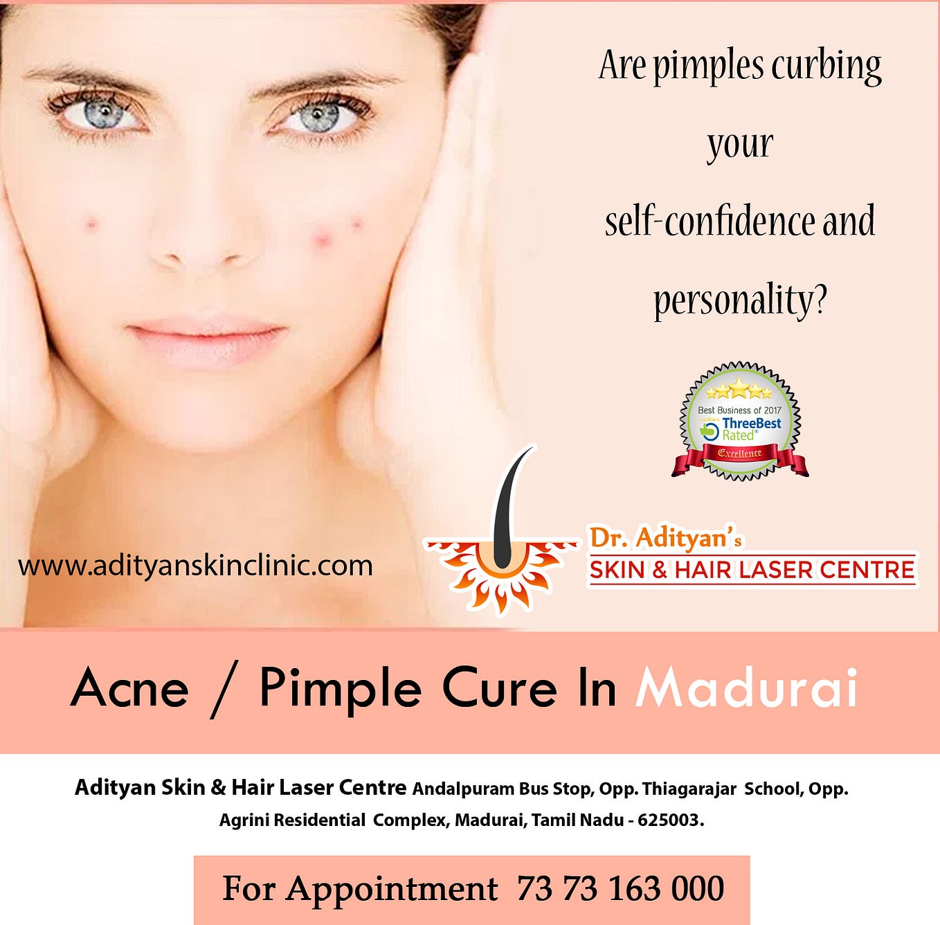 No More Pimples — Get Help From The Specialists of Acne/Pimple ...