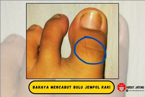Muncul Hewan Dari Saluran Kran Air - About Jateng - Medium
