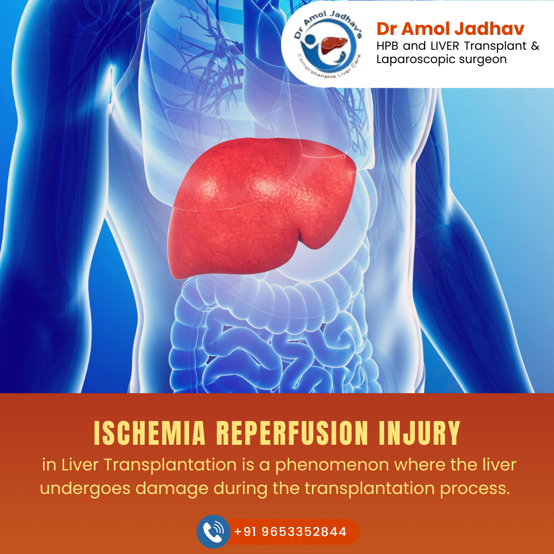 Minimally Invasive Approaches for Liver Cysts and Tumors | Dr. Amol ...