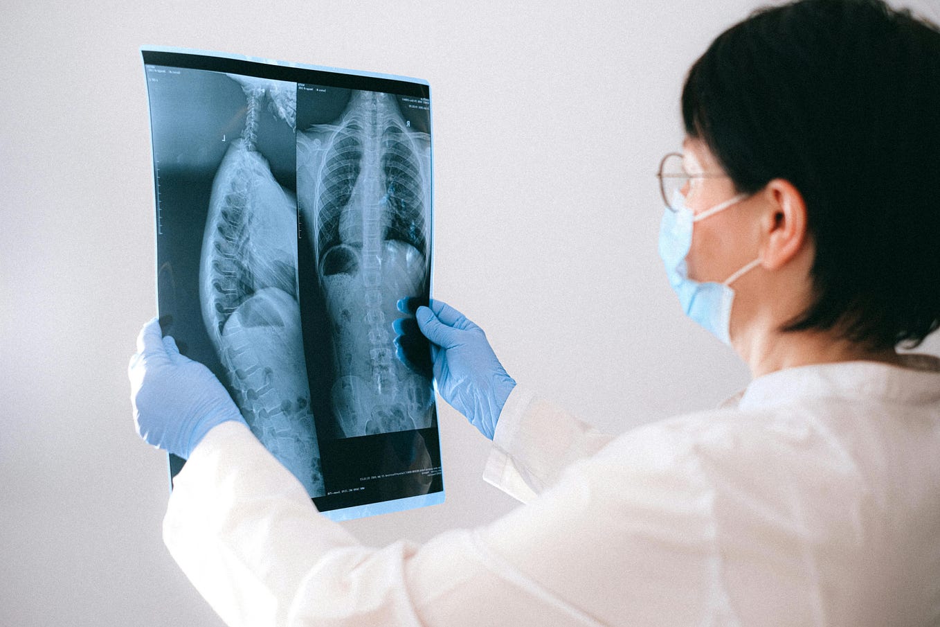 X-Ray Production: Principles, Mechanisms, and Applications | by SYED ...