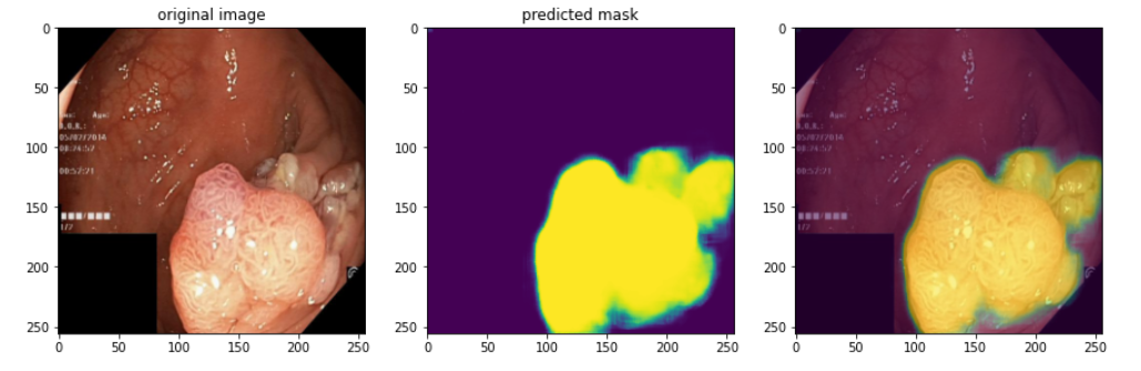 Image Segmentation using U-Net. Image segmentation is a process used to… | by Melike Gökdemir ...