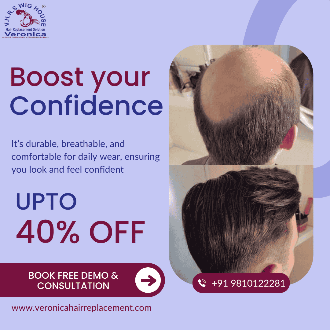 Premier Hair Replacement Solutions in Delhi: Transform Your Appearance ...