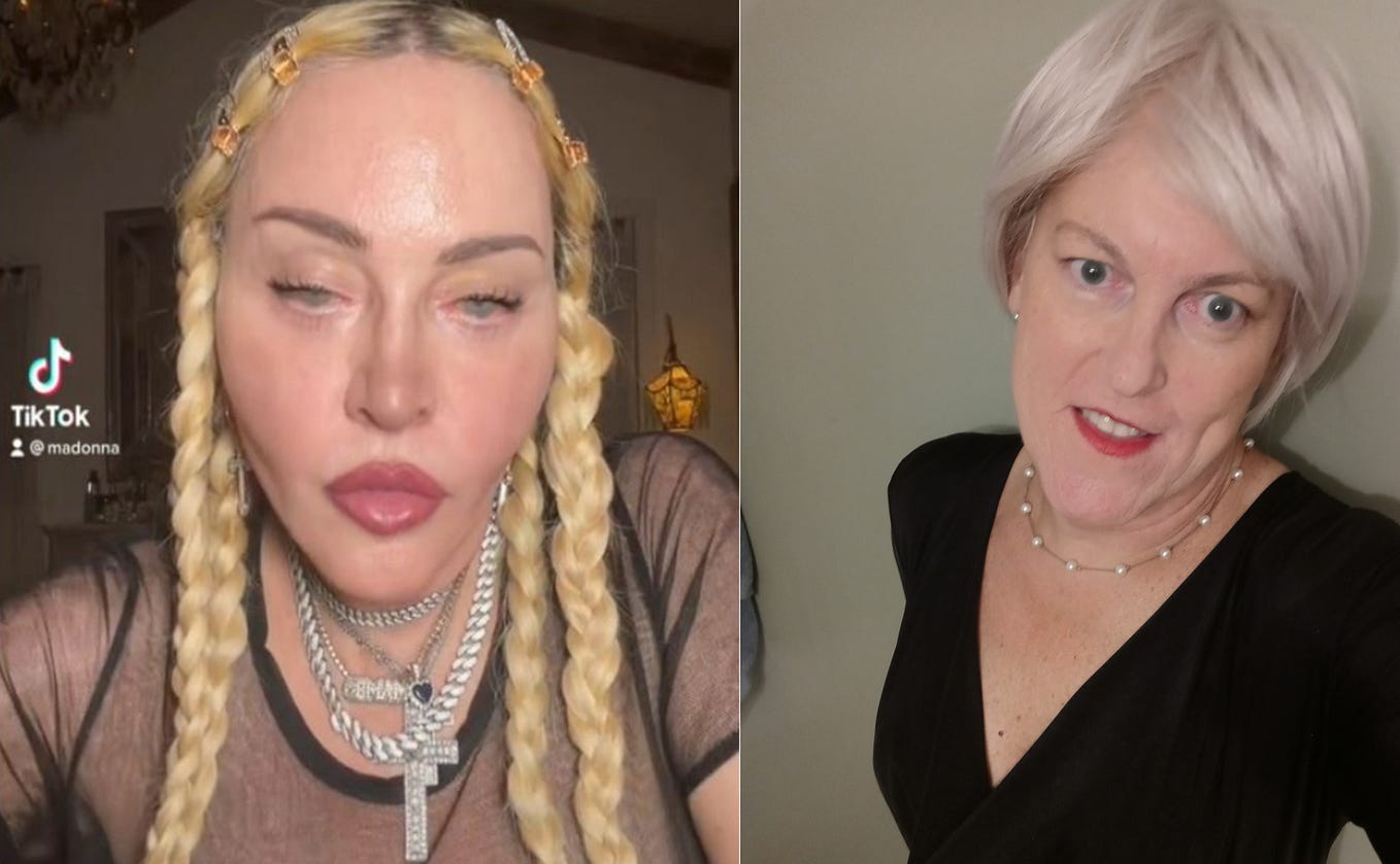 I am a Bald Transgender Woman. Gender, beauty, and acceptance | by ...