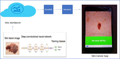 Building a Diabetic Retinopathy Prediction Application using Azure Machine Learning | by anusua ...