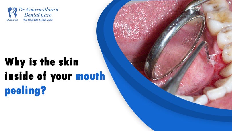 Why do some people have wavy tongue edges? | by Amarnathan | Medium