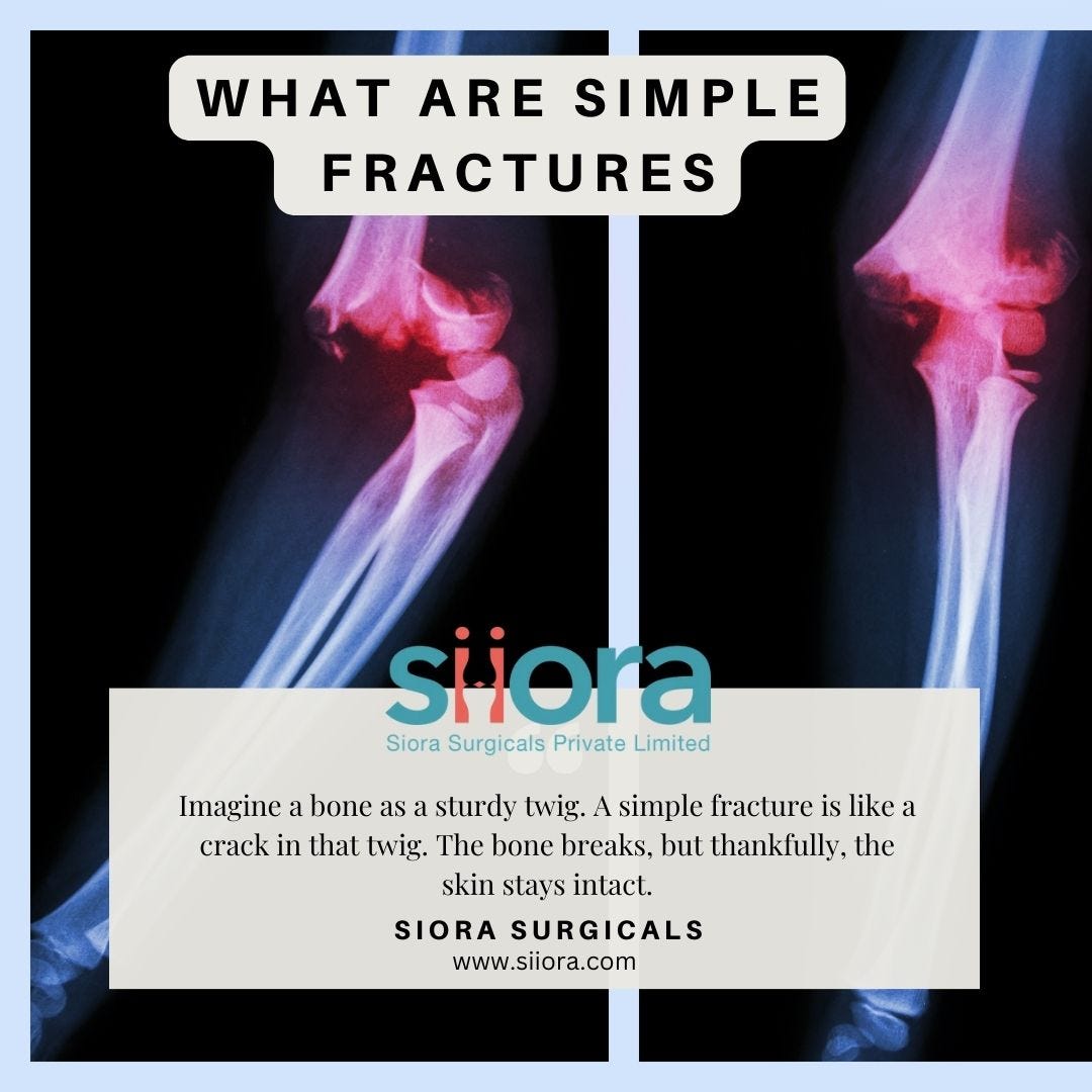 Understanding Hip Arthroplasty — A Quick Guide - Siora surgical - Medium