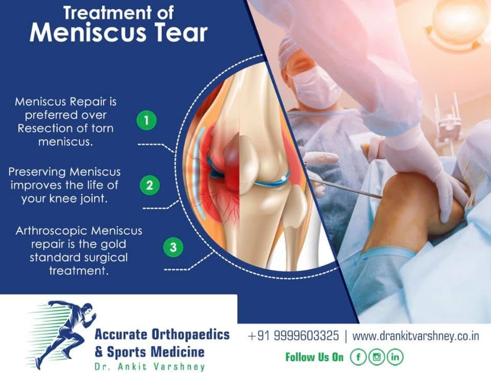 The Top Knee Replacement Surgeries Available in Delhi | by Dr. Ankit ...