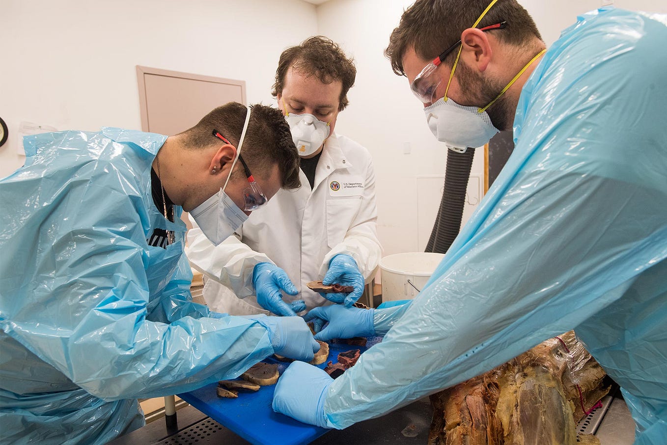 Applying the V-Model to Medical Device Development: A Step-by-Step ...