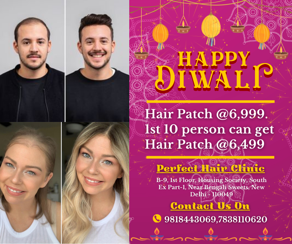 Transform Your Look with Hair Patches: A Comprehensive Guide | by ...