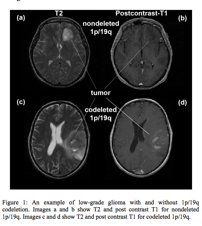 Google DeepMind -Improving the interpretability of “Black Box” in ...