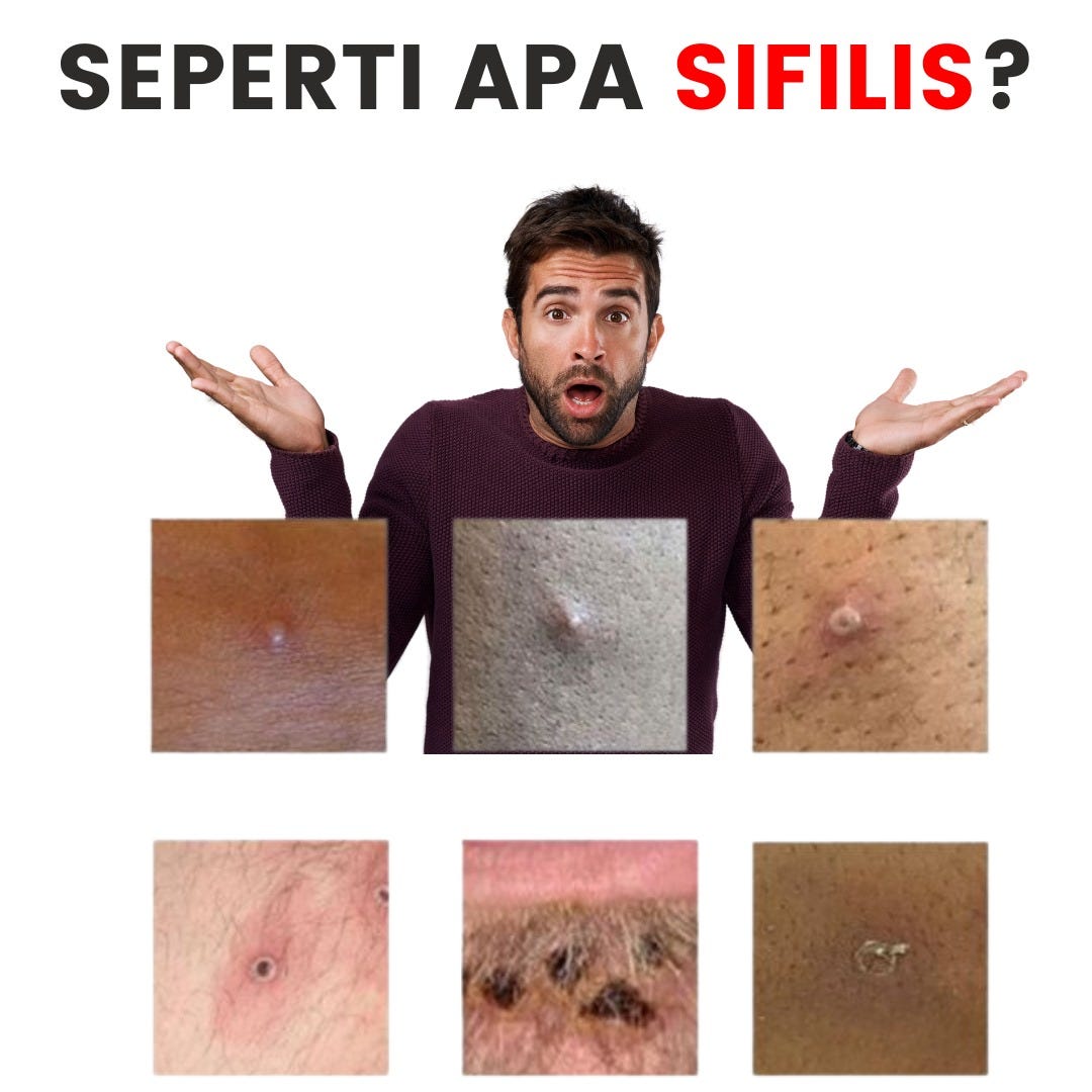 Rawatan Sifilis Pada Wanita — Mengenali Gejala Sifilis pada Wanita, Apa ...