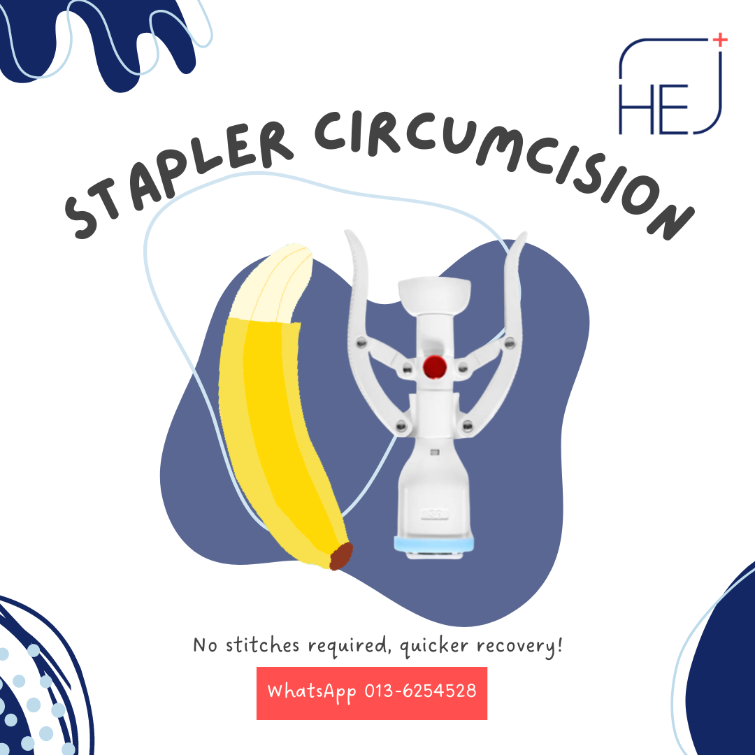 Vital Facts to Know about Stapler circumcision in Malaysia | by ...