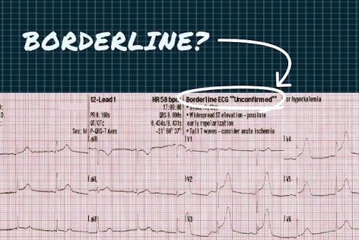 BPM Full Form: Decoding the Beats Per Minute in Heart Health | by ...