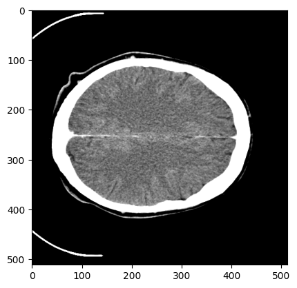A Python script to sort DICOM files | by Alexander Weston, PhD | Towards Data Science
