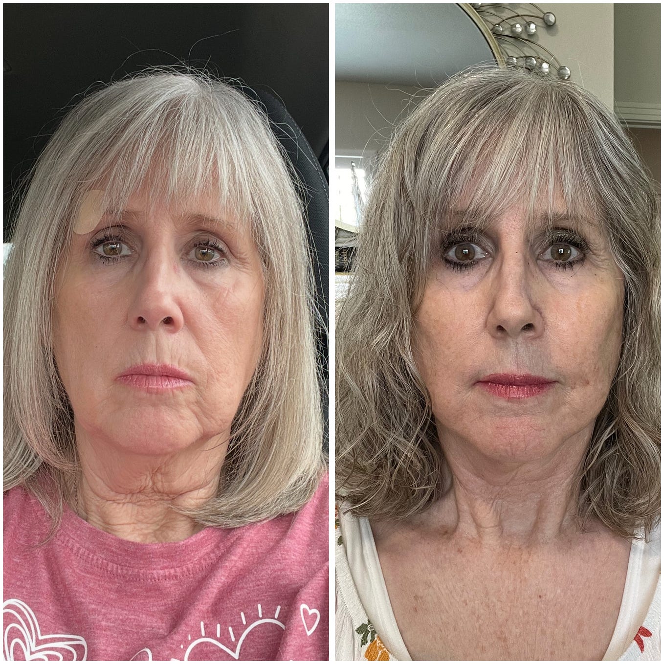 I’m sure you have read about this before because while being here with ...