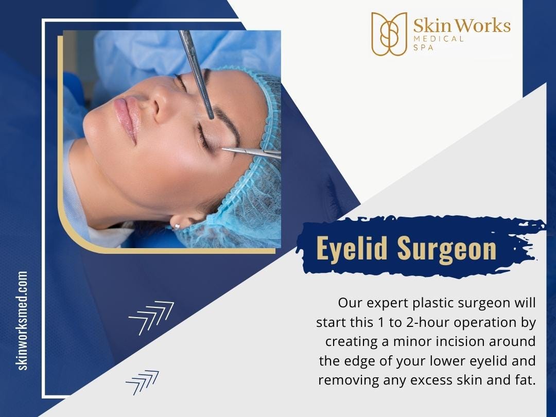 Droopy Eyelid Surgery Near Me - Skin Works Medical Spa - Medium