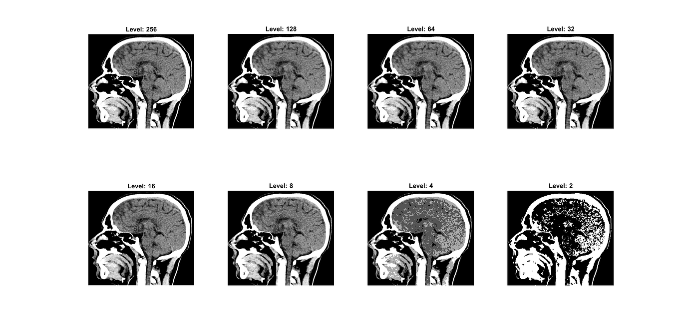 Real-time Object Tracking and Classification with OpenCV and DenseNet | by Chen-Yu Chang | Medium