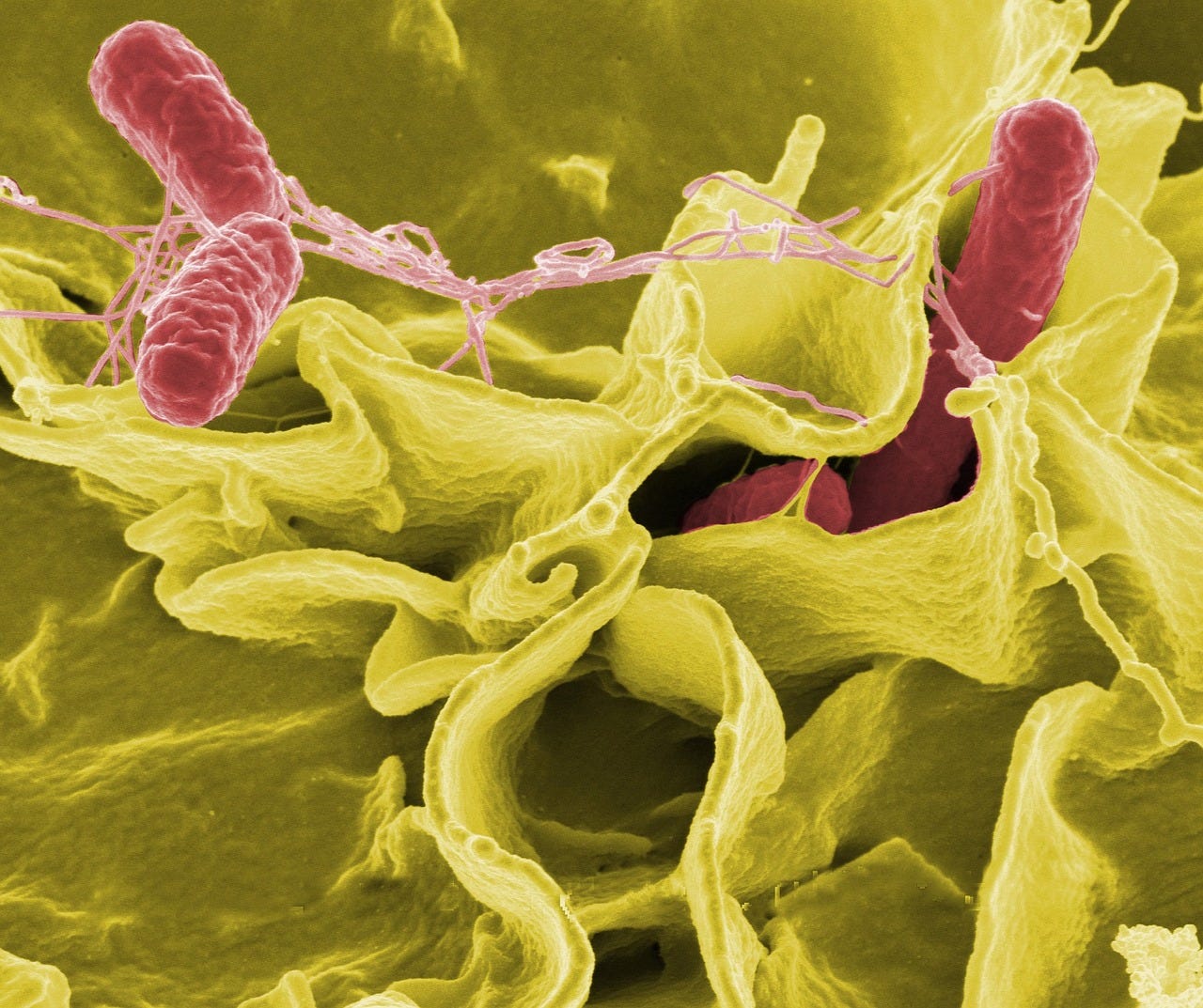 Vitamin B12: Can Gut Bacteria Synthesize It? | by Shin Jie Yong, MSc ...