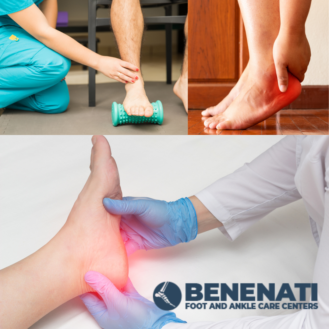 What exactly causes heel pain?. The plantar fascia, a band of tissue in ...