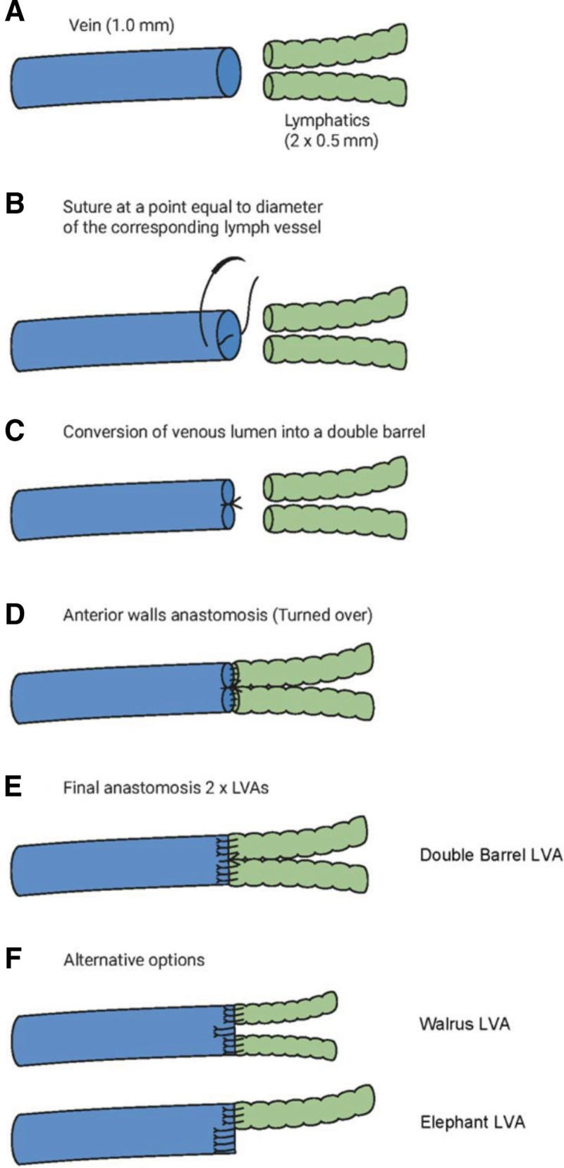 Long Short Term Memory Lstm Neural Networks As An Alternative To Convolutional Neural Networks