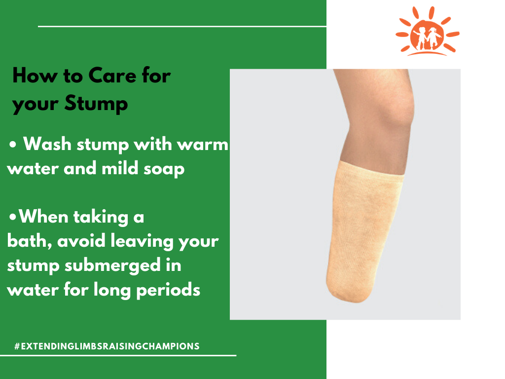 The K-Levels For Lower Limb Amputees | by The IREDE Foundation | Medium