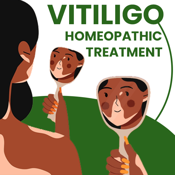 Exploring Effective Varicocele Treatment Without Surgery A