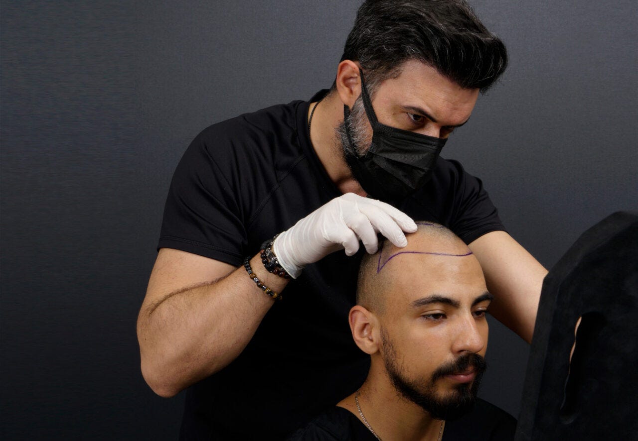 The Ascent Of Prp Hair Treatment In Dubai Patterns By Eishadynamic