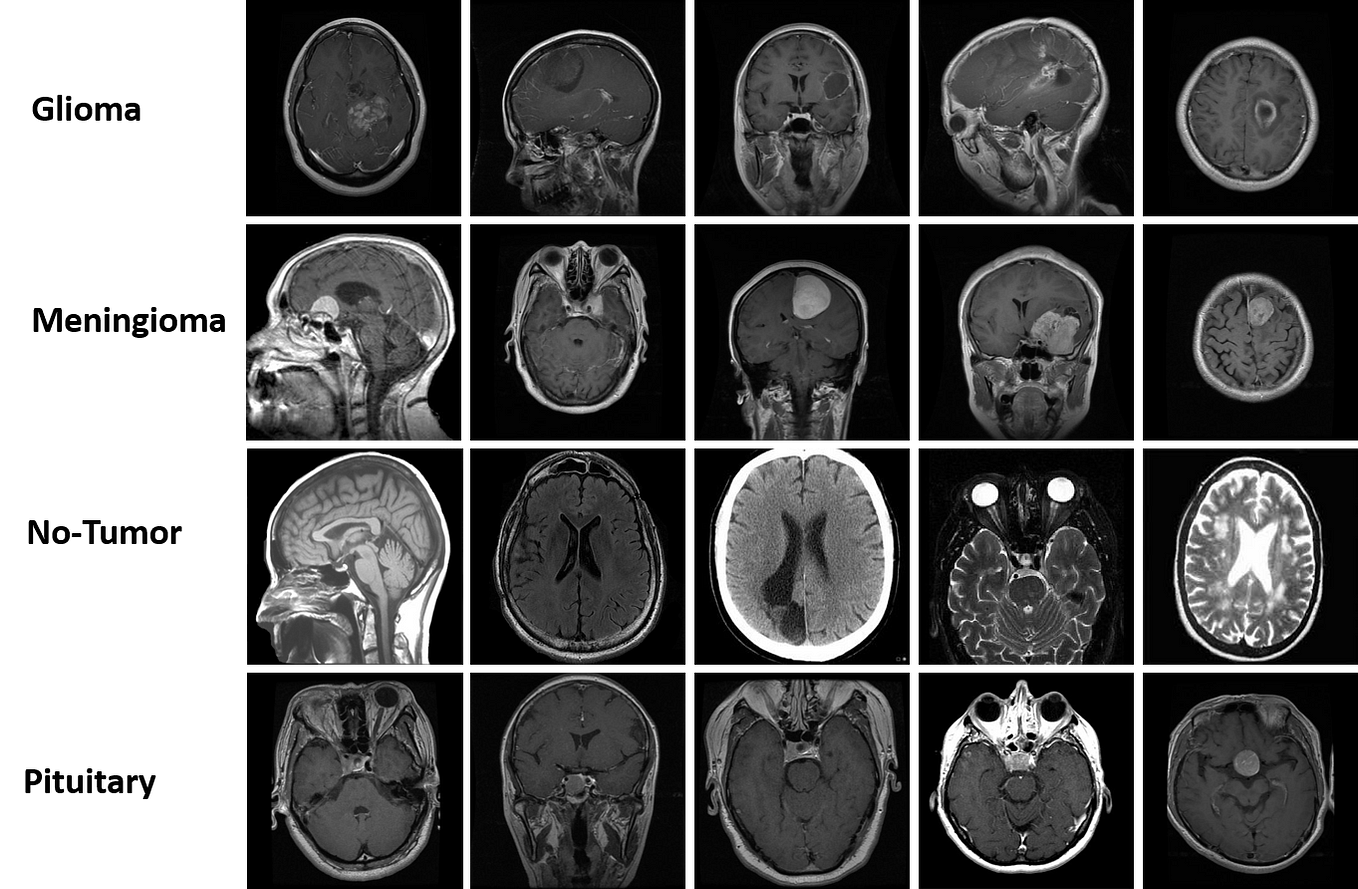 Image Classification Using Neural Network A Guide With Fastai And Gradio By Aravind Raju 0740