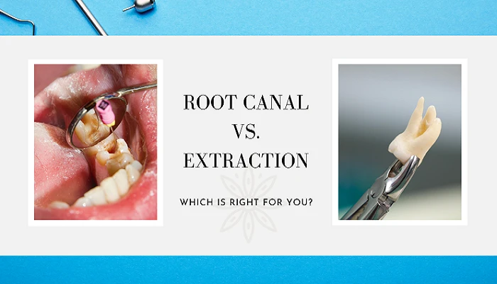 How Your Cosmetic Dentist Can Restore A Broken Or Chipped Tooth | by Robstown Smiles | Medium