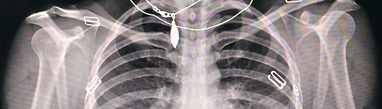 Beginner Tutorial Image Classification Using Pytorch Medium